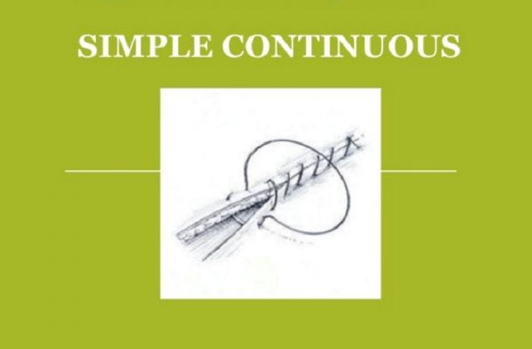 Simple Continuous Suture Pattern